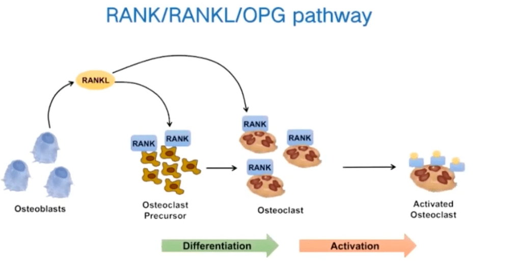 CSCO 2020｜专家解读《CSCO骨巨细胞瘤诊疗指南2020》——“小众”但不容小觑_患者