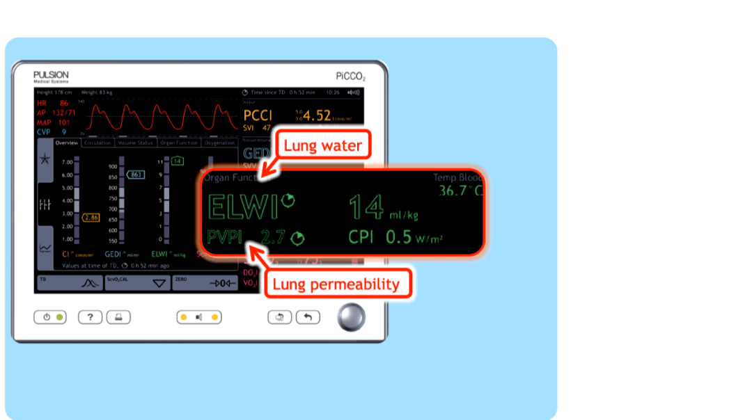 PiCCO在ICU中的应用_进行