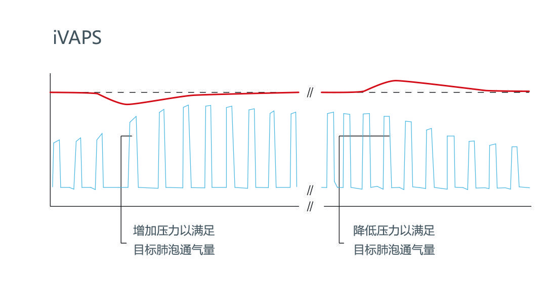 剖析瑞思迈呼吸机Lumis150 VPAP ST_病人