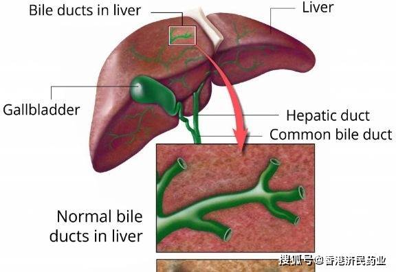 linerixibat治疗PBC患者胆汁郁积性瘙痒临床数据：显著改善_研究