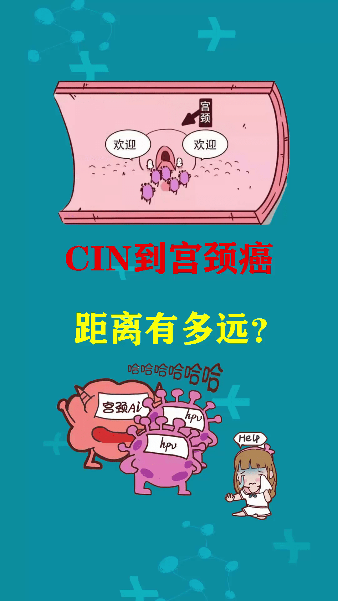 Hpv感染,cin到宫颈癌,距离有多远?