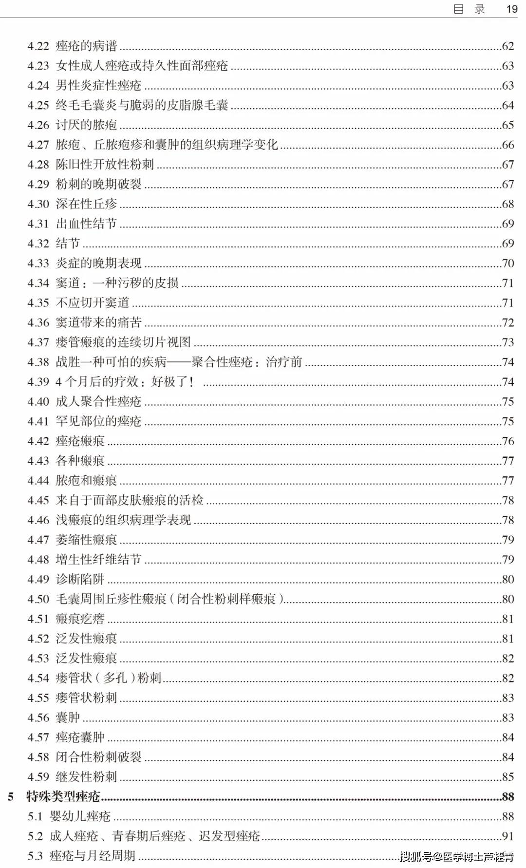 Kligman教授--经典代表作《Plewig & Kligman痤疮与玫瑰痤疮》即将出版_美容