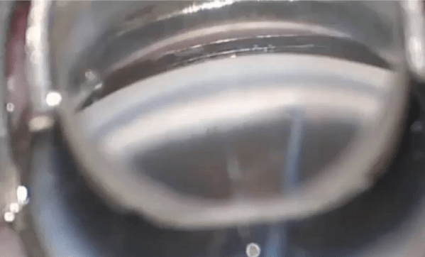 专题回顾 |开往春天——GATT 与 PCP 青光眼手术研讨会（上）_中国医师协会_iTrack_临床