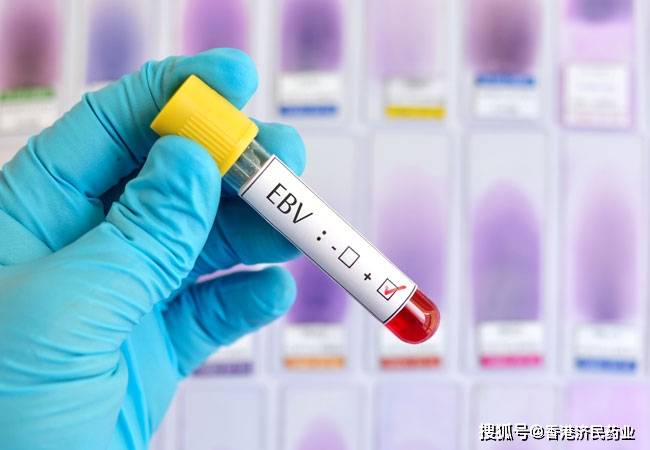 欧盟批准Ebvallo(tabelecleucel)用于治疗移植后淋巴增生性疾病_患者_细胞_疗法