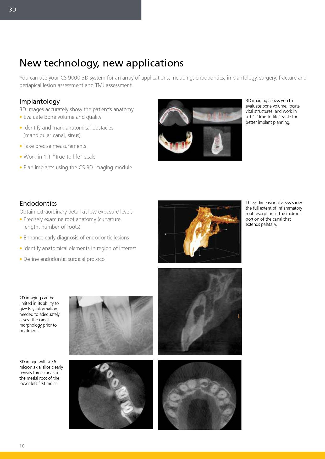 Carestream 9000-搜狐大视野-搜狐新闻