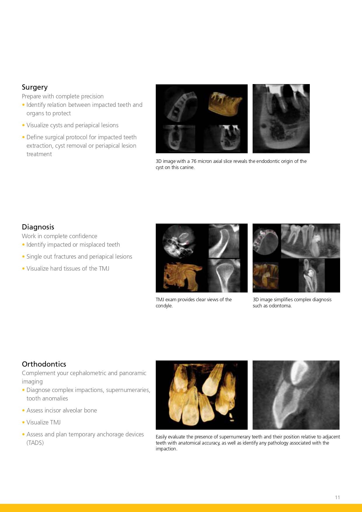 Carestream 9000-搜狐大视野-搜狐新闻