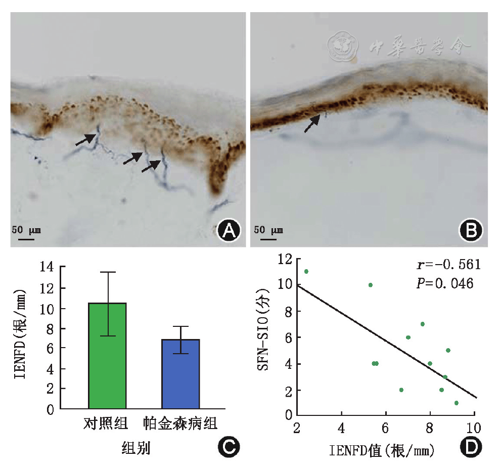 【临床研究】帕金森病患者皮肤神经磷酸化α-突触核蛋白研究_-syn