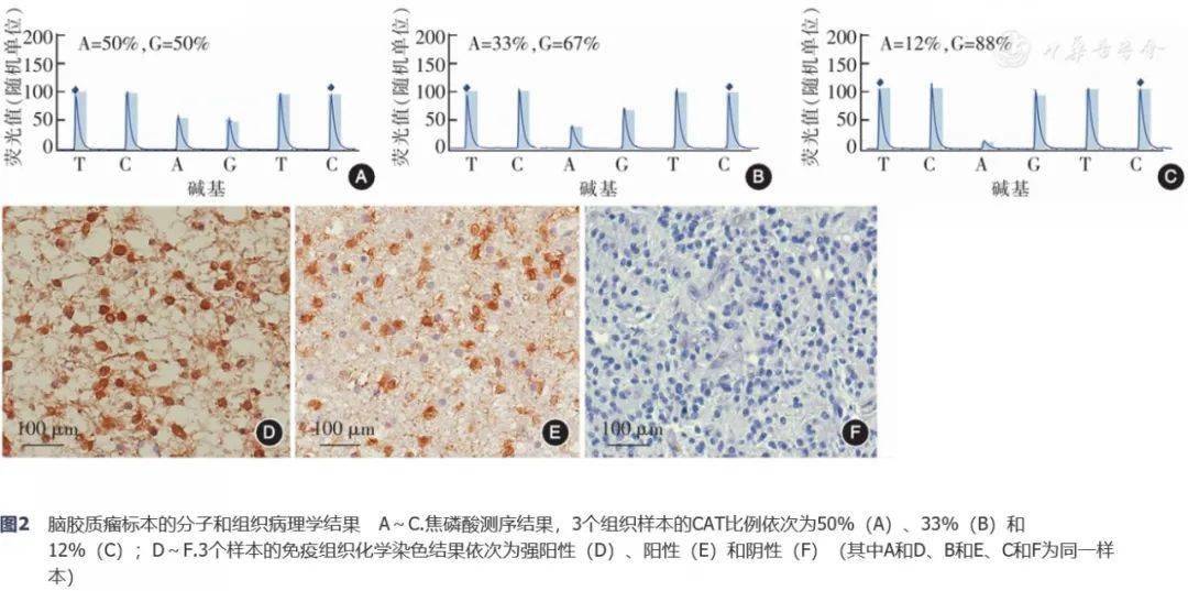 IDH1（R132H）_脑胶质瘤