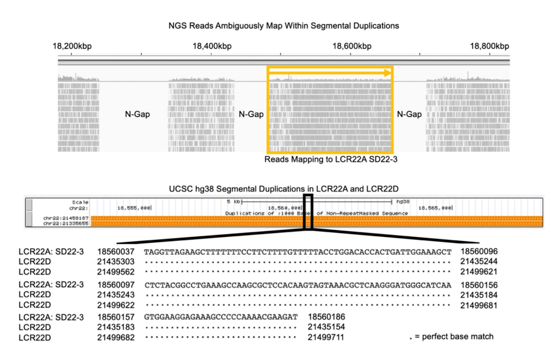 【有突破，不“遗”憾】22q11.2微缺失综合征_Bionano