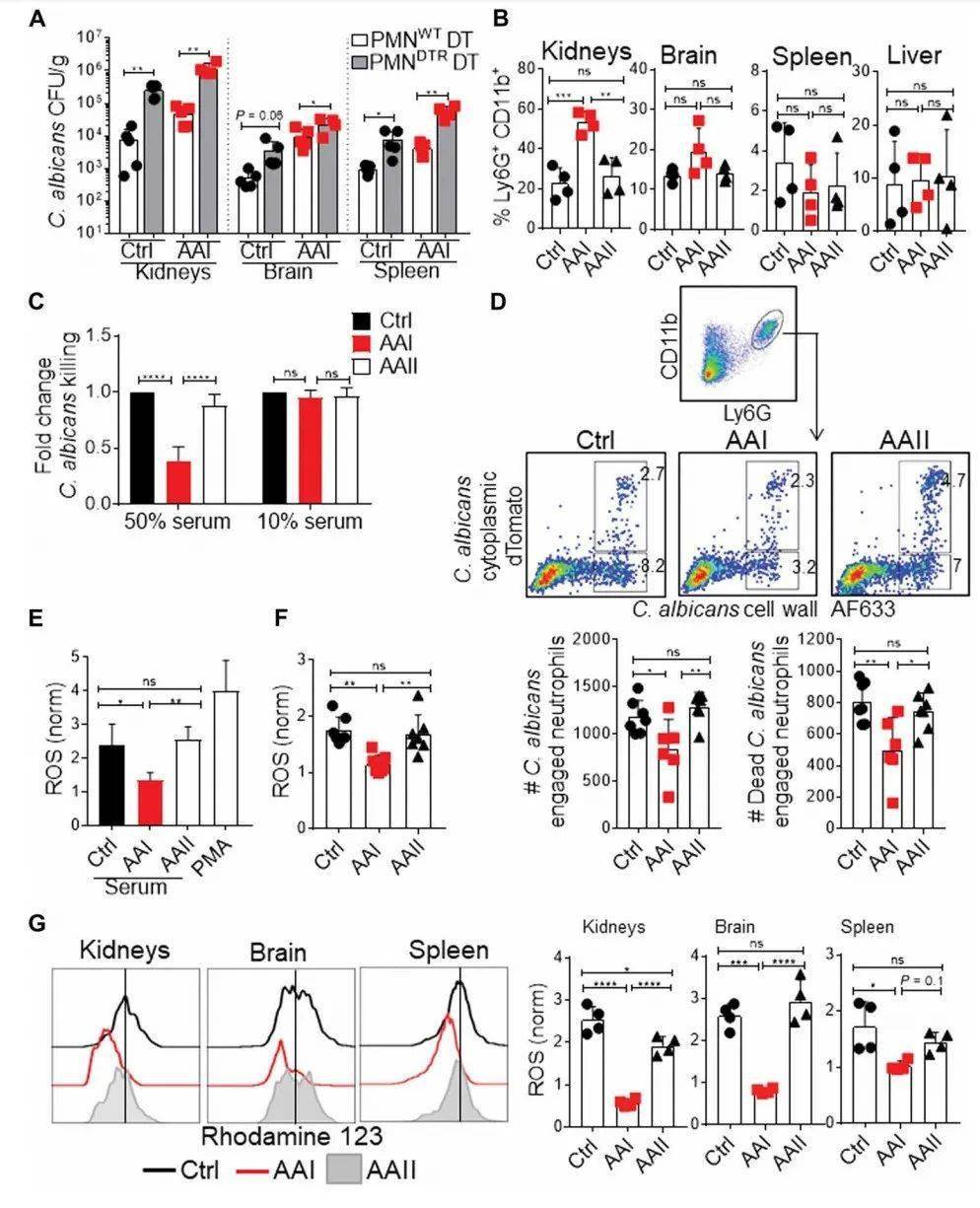 Sci Trans Med：恢复葡萄糖摄取可挽救肾脏病小鼠中性粒细胞功能障碍并保护其免受真菌感染_患者