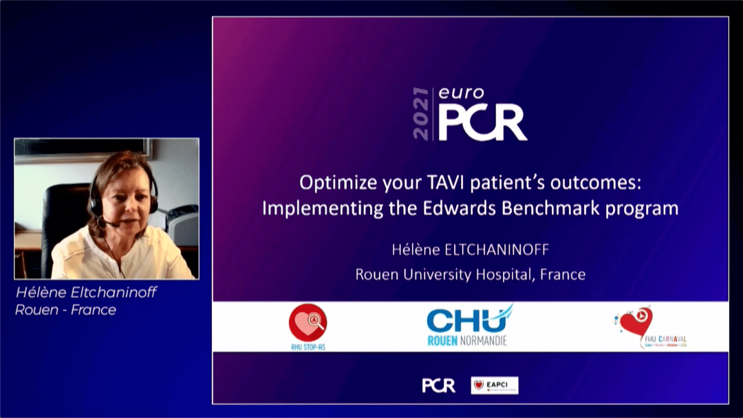 极简式TAVI潮流下，如何进一步实现尽早出院？_患者