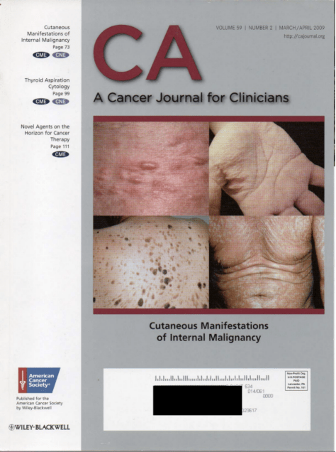 刚刚！2021年最新SCI影响因子发布，CA封神高达508.7分_期刊