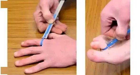 银屑病关节炎疾病活动度如何评估？还是得靠这个「法宝」！_临床