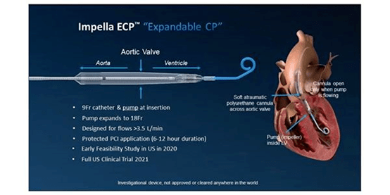 【解读】人工心脏技术的历史发展及国内外技术现状_装置_叶轮_血液