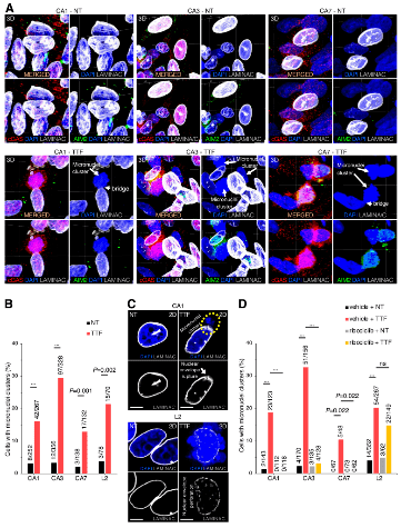 【精选编译】TTFields靶向cGAS/STING通路和AIM2炎症小体激活GBM适应性免疫_诱导_细胞系_治疗