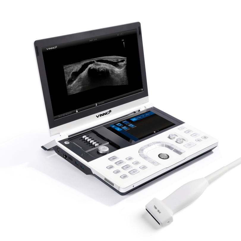 冠军背后的“超能团队”，国家队康复专家来了_运动_超声_肌肉