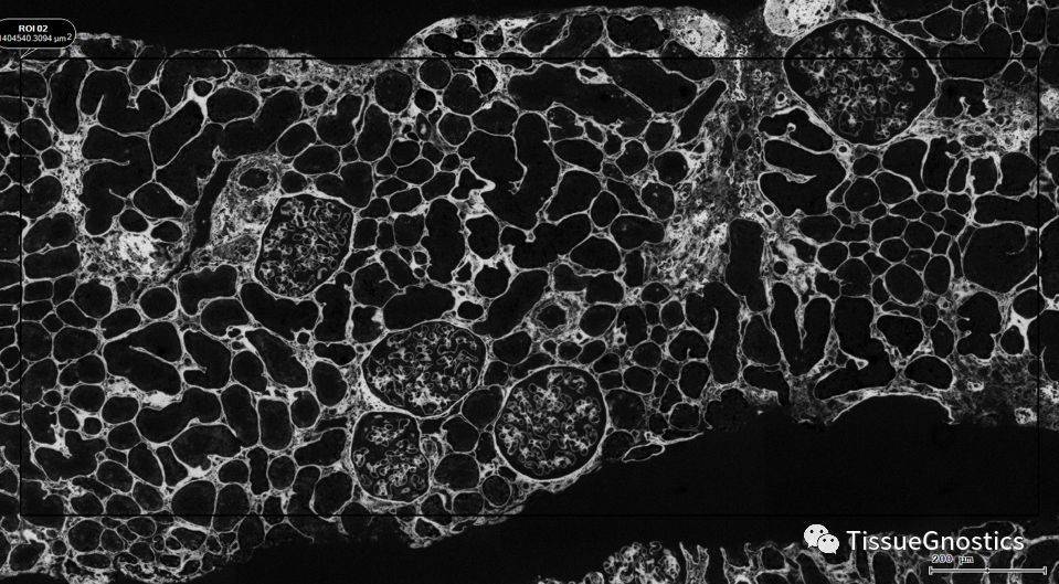 肾脏活检组织PASM染色定量分析实例_识别_进行_实验