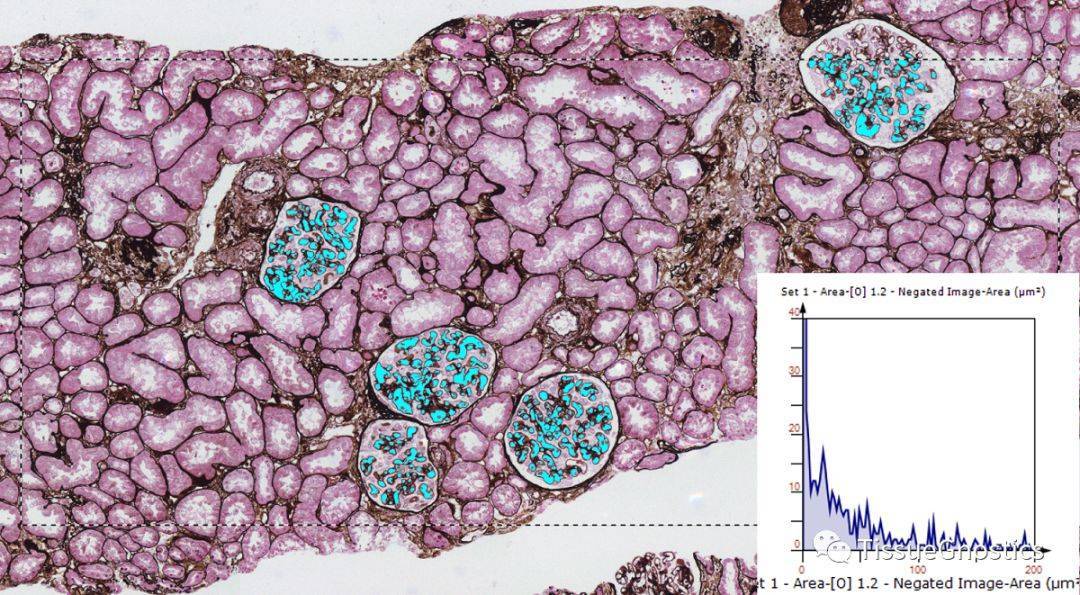 肾脏活检组织PASM染色定量分析实例_识别_进行_实验