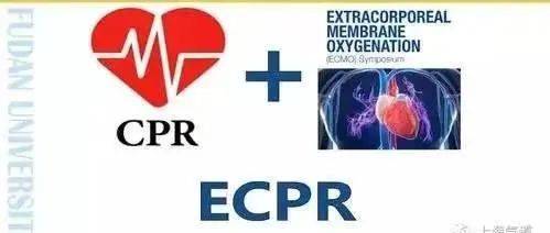 “起死回生”！沈阳胸科急症团队：ECPR打响生命保卫战！_患者_曾先生_心脏
