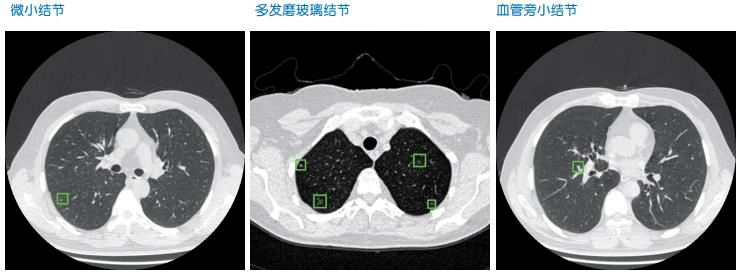疾病诊断又添“侦察兵”！Optima CT620上线-搜狐大视野-搜狐新闻