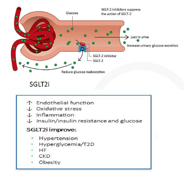 追寻光芒 必有远方——2型糖尿病合并COVID-19患者应用SGLT2i的安全性_达格列_血糖_临床
