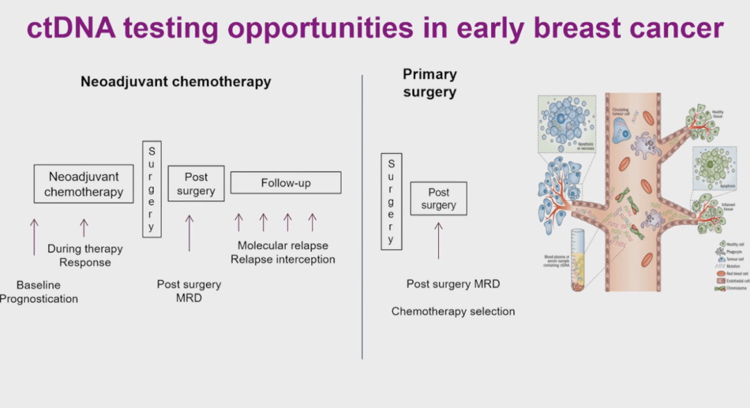 SGBCC 2023丨刘强教授点评：ctDNA用于早期乳腺癌的复发风险监测_研究_患者_治疗